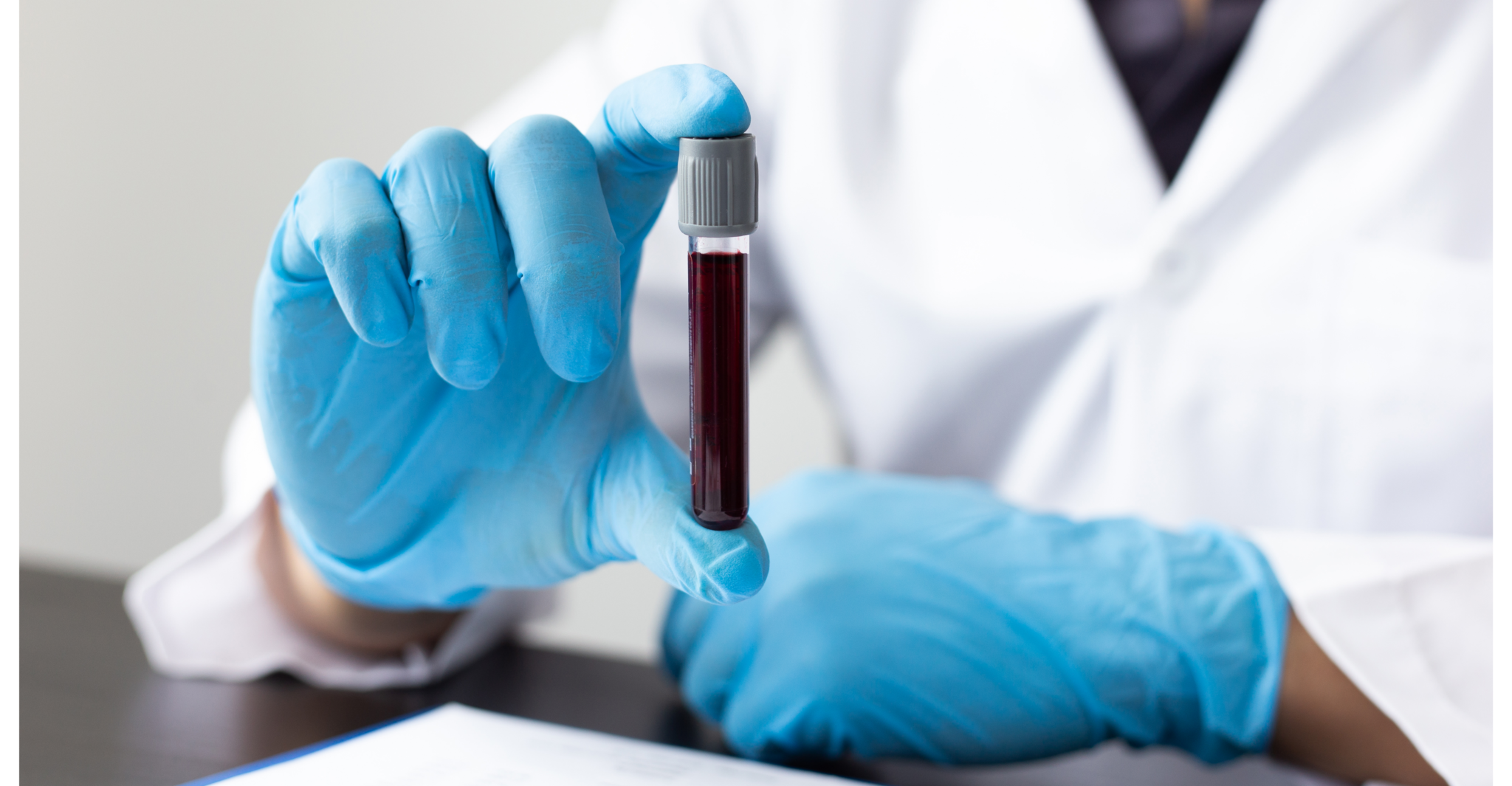 Test OGTT – czym jest doustny test obciążenia glukozą? - EpozytywnaOpinia